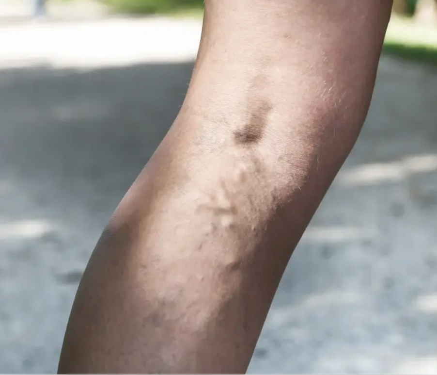 One Vascular | Premier Vascular Surgery Group in Ontario