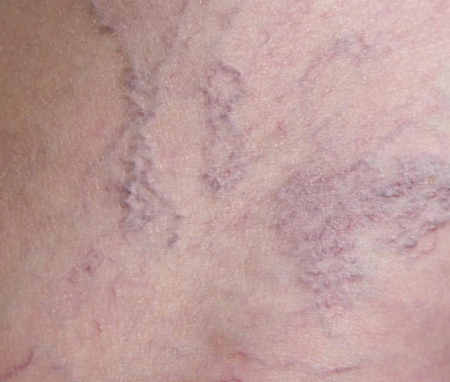 One Vascular | Premier Vascular Surgery Group in Ontario