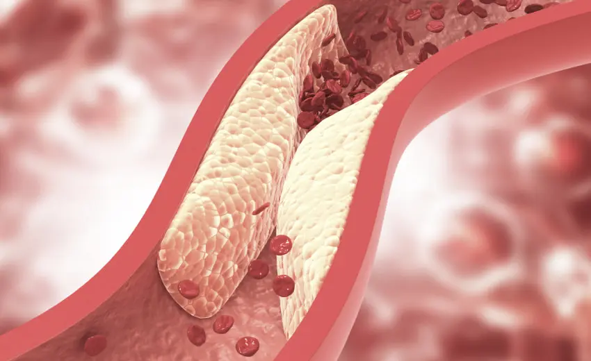 Vascular Health In Ontario: Understanding Conditions, Treatments ...
